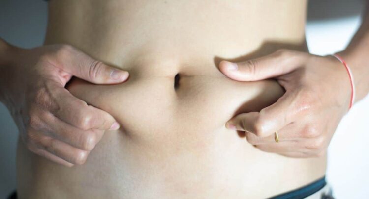 Fat Reduction Treatments | Available Options and How to Determine What ...